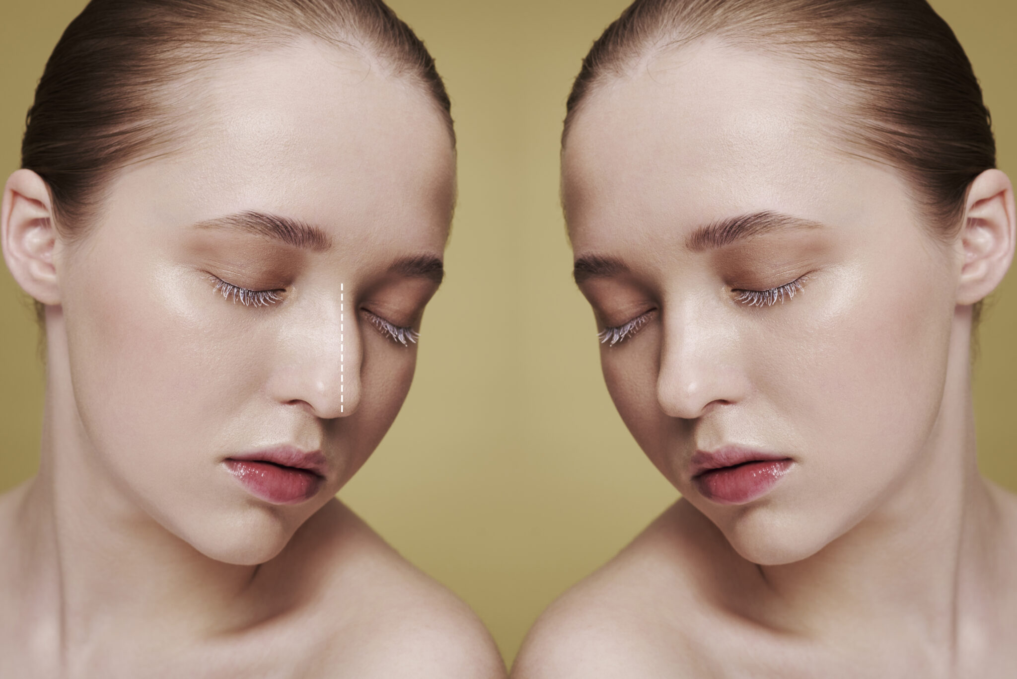 Crooked Nose: Causes, Symptoms, Treatments | Hooked Nose