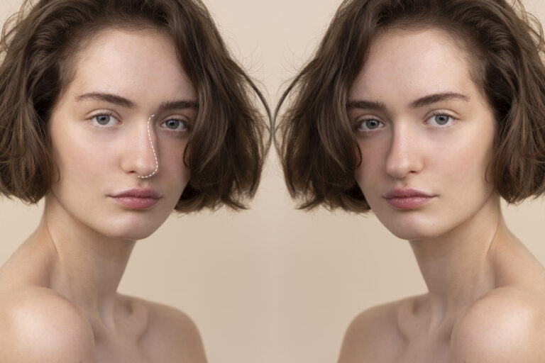How to Fix a Crooked Nose? | Dr. Cem Altindag